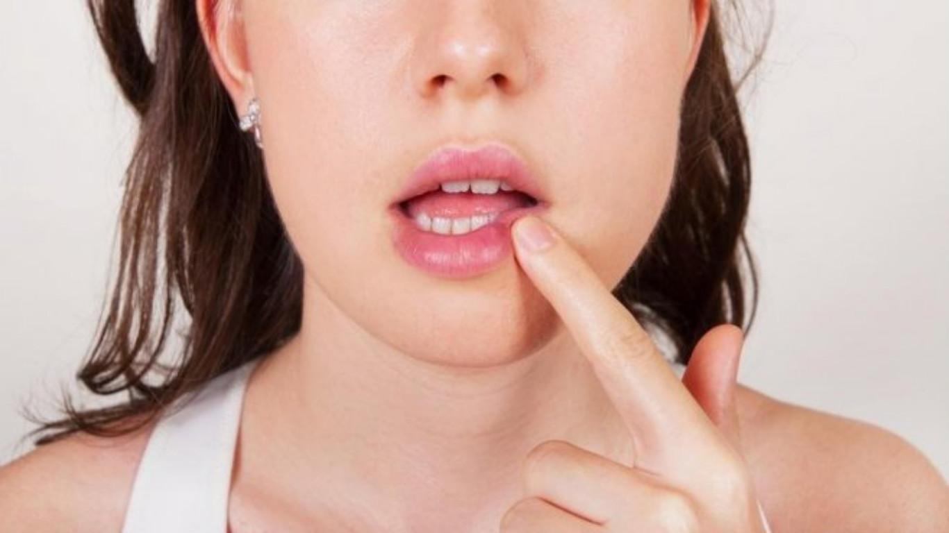 Opar, opar, opar! Jak na něj vyzrát? – G.cz